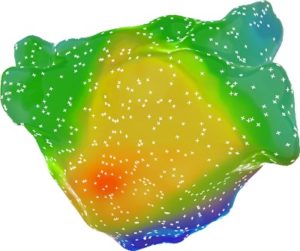 Biosense Webster launches latest generation of Carto heart mapping ...