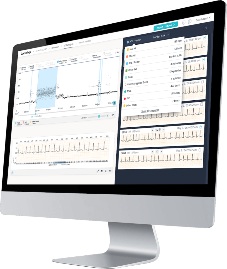 Cardiologs and MicroPort CRM partner to offer AI-based ECG system in ...