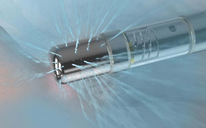Biosense Webster receives CE mark approval for QDot Micro ablation catheter
