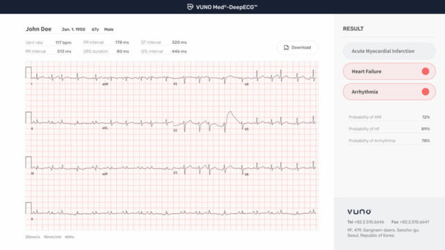 Vuno’s AI-based ECG analysis software gains breakthrough designation - Cardiac Rhythm News