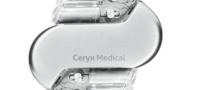 Ceryx Medical launches Cysoni bionic device for respiratory sinus ...