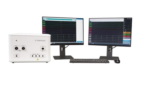 FDA clears ECGenius high-fidelity, low-noise electrophysiology ...