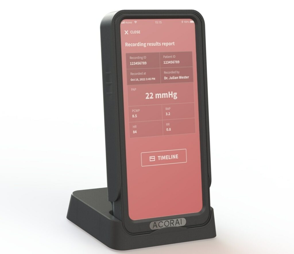 First patient enrolled in global study of heart failure device trial ...