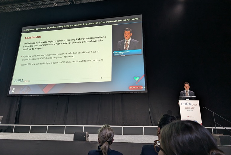 Post-TAVI pacemaker implantation linked to long-term increase in ...